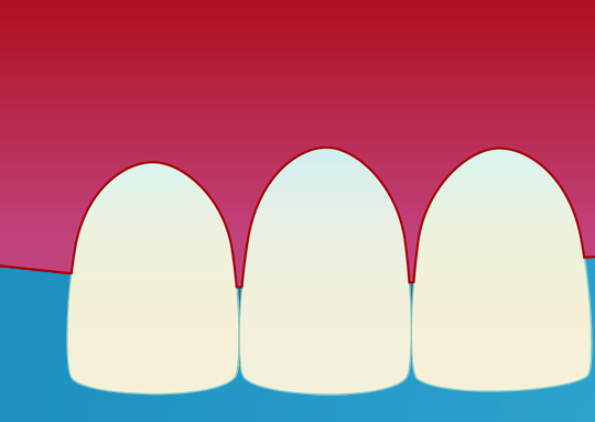 Fasetter | Bakke Tannlegekontor Trondheim
